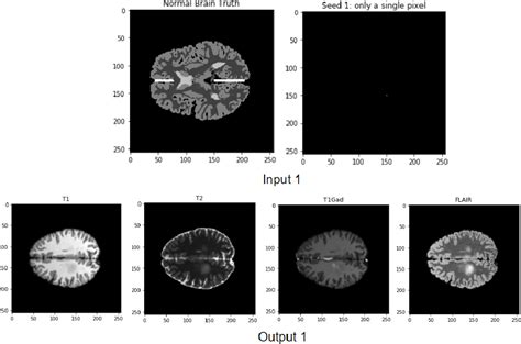 Figure 1 From Computer Generative Method On Brain Tumor Segmentation In