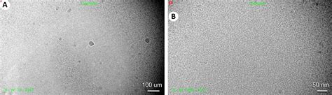 Cryo Em Screening On Jeol Jem 1400flash Jeol Resources
