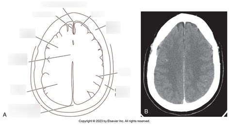 Cross Sectional Anatomy Image 2 Diagram Quizlet Cross Sectional Anatomy Image 2 Diagram Quizlet