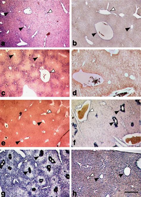 Localization Of Fmo Mrnas In Mouse Liver Antisense Probes For Mrnas