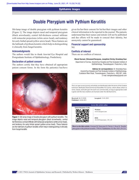PDF Cover Image Double Pterygium With Pythium Keratitis