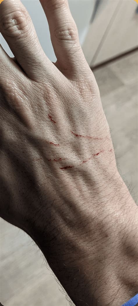 Squirrel Scratched My Hand R Squirrels