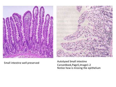 What Is A Fixative In Histology At Audrey Cunningham Blog