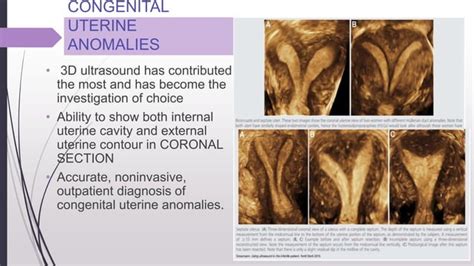 Role Of Ultrasound In The Infertility Management Ppt