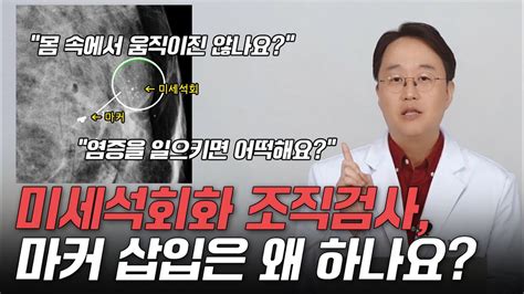 미세석회화 조직검사 마커 삽입 왜 하나요 Youtube