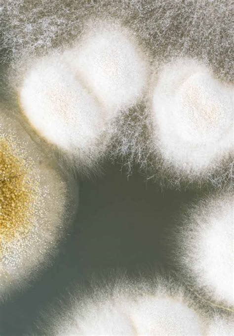 Detection Of Pathogens Using Microfluidics And Biosensors Intechopen