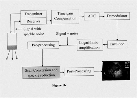 Ultrasound Imaging Methodtechnique For Speckle Reductionsuppression In An Improved Ultra Sound