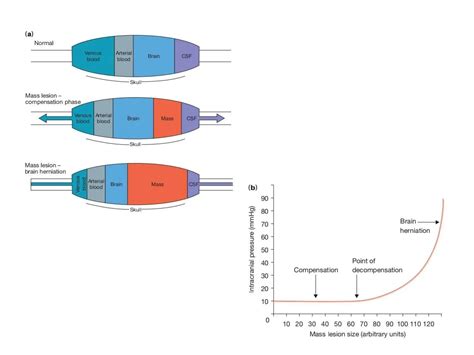 Tbi Definion And Their Types Well Explained Ppt