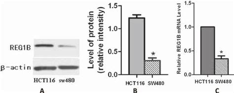 Western Blot And Quantitative Reverse Transcriptase Polymerase Chain