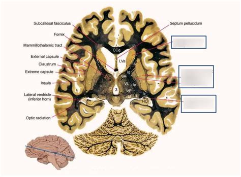 Basal Ganglia Horizontal Section Diagram Quizlet