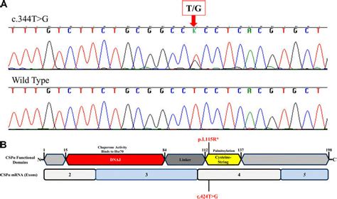 dna sequence traces of dnajc5 exon 4 of an early stage ad ancl patient