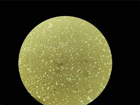 India Ink Staining Of Csf Showing C Neoformans Download Scientific Diagram