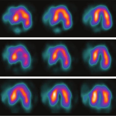 Pdf Deep Learning Guided Attenuation Correction In The Image Domain