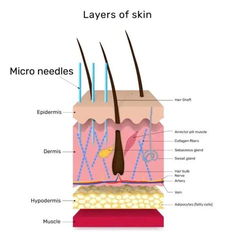 Apakah Kepala Botak Plontos Masih Bisa Tumbuh Rambut Roegan