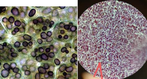 Slb I Flashcards Quizlet