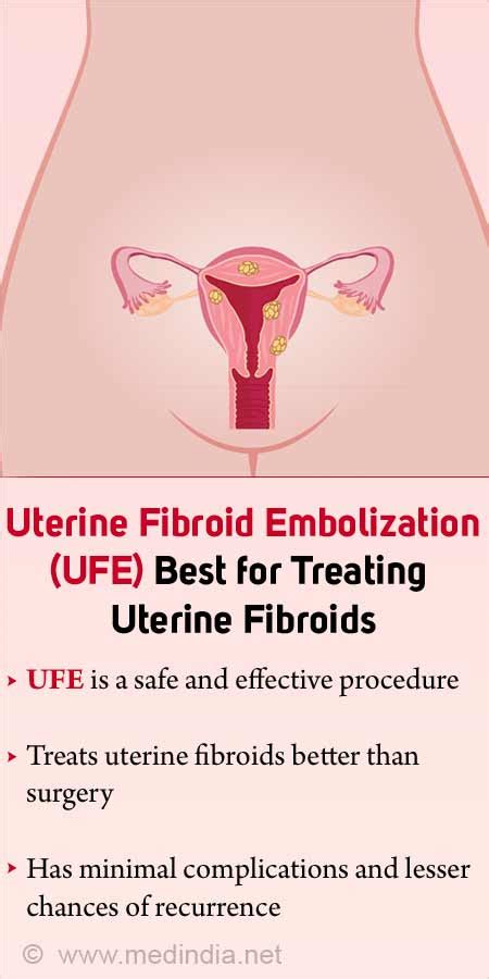Uterine Fibroid Embolization Complications Uterine Fibroids After