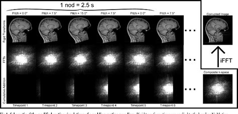 Figure 1 From Simulating Rigid Head Motion Artifacts On Brain Magnitude Mri Dataoutcome On