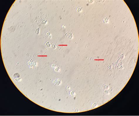 Could Anyone Help Me See If It Is Contamination In Cell Culture Researchgate