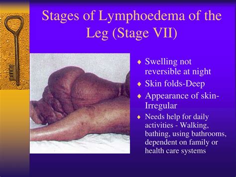 Brunner Classification Of Lymphedema At Joshua Chafin Blog
