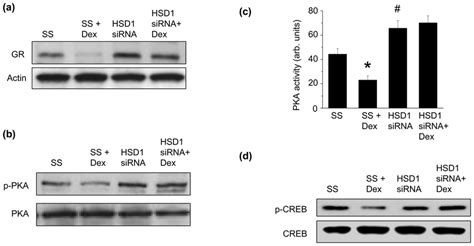 11β HSD1 regulates glucocorticoid receptor expression HCSMC were Download Scientific Diagram