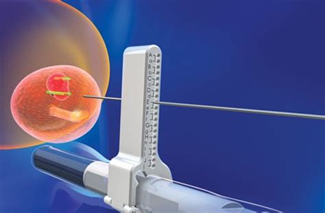 Advanced Medical Systems