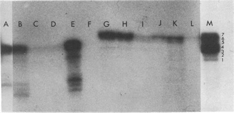 Si Nuclease Analysis Of H4 Primer Extension Bands Track M Shows The Download Scientific