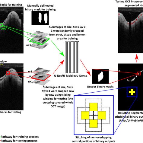 Workflow For Automated Stent Strut Segmentation See The Text For