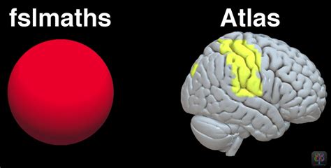 Harvard FSL Workshop 2021 Andy S Brain Blog