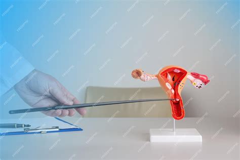 그의 바탕 화면에 여성 생식 기관의 의사 산부인과 의사 가리키는 모델 프리미엄 사진