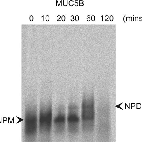 Expression Of Recombinant Muc5b Cooh Terminal Protein Domain A Download Scientific Diagram