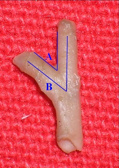Angles Measured A Internal Angle B Geometric Angle Download Scientific Diagram