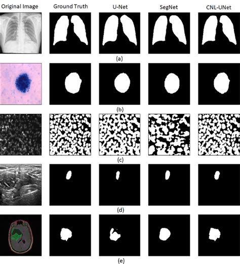 Comparison Of U Net Segnet And Cnl Unet On Five Datasets A Chest Download Scientific