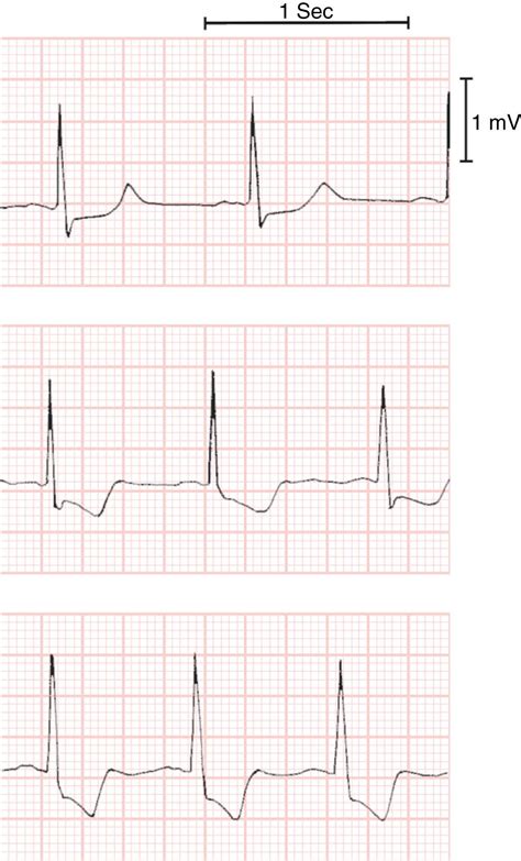 Cardiovascular Monitoring Clinical Tree