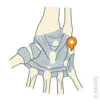 Os Pisiforme E Anatomy Imaios