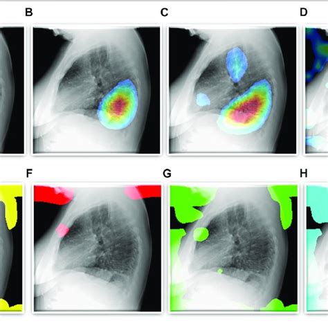 Performance Curves Achieved Using Slsqp Based Weighted Averaging Of Download Scientific