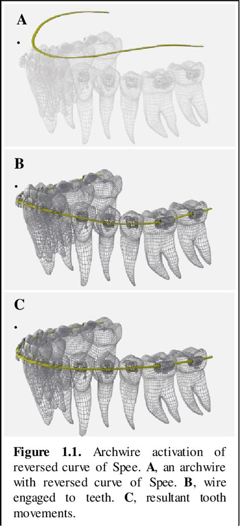 Figure 11 From Digital Assessment Of Three Dimensional Tooth Movement