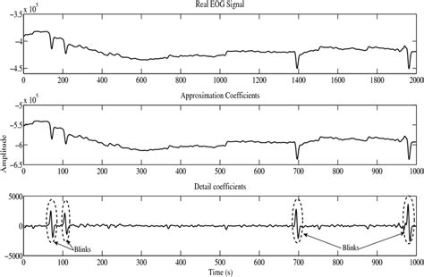 The Haar Wavelet Decomposition For Vertical Eog Signal Download