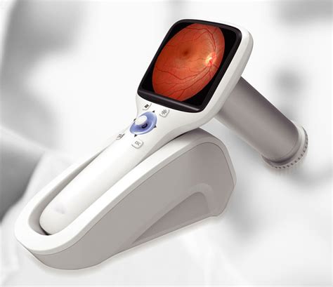 Portable Fundus Camera Handheld Fundus Camera Fc 200 Medical