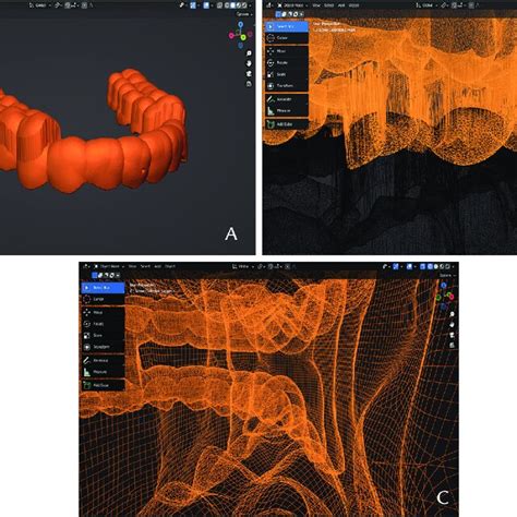 A Design Of Combined Occlusal Devices B Mesh Of Combined Occlusal Download Scientific