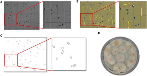 Application Of Automatic Method In Fungal Spore Counting Fungal Spores Download Scientific
