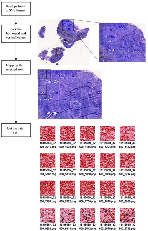 Lung Cancer Metastasis Dataset Production Process Download Scientific Diagram
