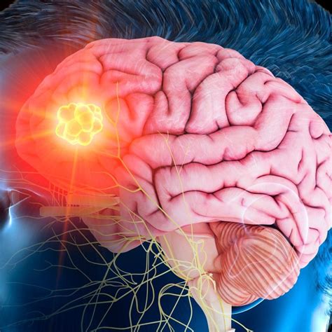 Brain Tumor Mri Scans Kaggle