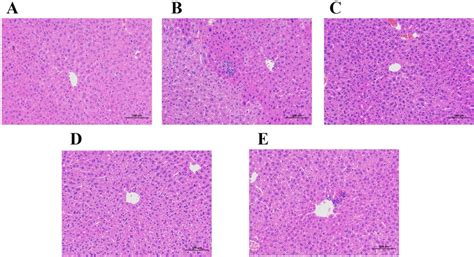 Effects Of T37a On The Morphology Of The Liver Of Aging Mice Induced By