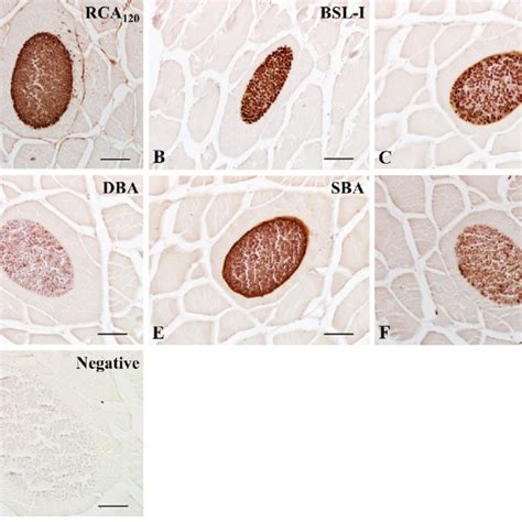 Lectin Binding Patterns Of Spores In The Muscles Of Olive Flounder Download Table