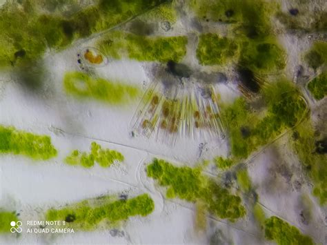 Algae Cell Under Microscope