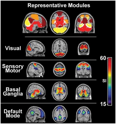 Visual Cortex