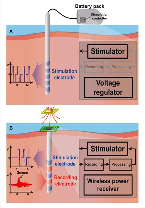 two stimulation schemes open loop and closed loop stimulation a