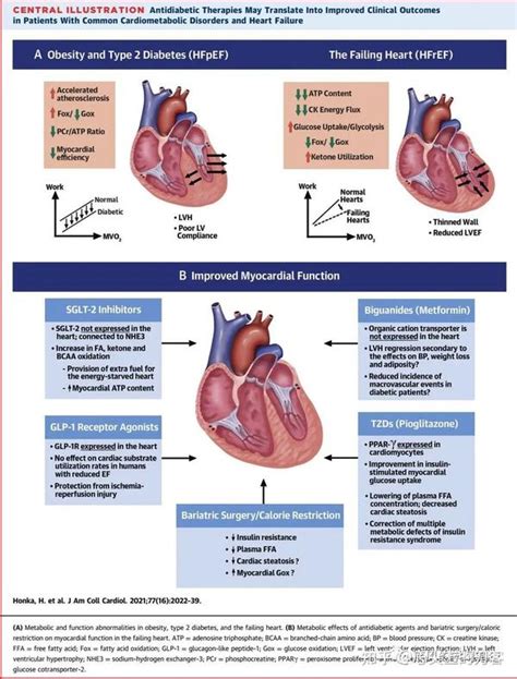 心肌代谢的治疗手法 知乎