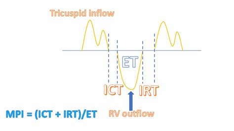 Assessment Of Right Ventricular Diastolic Function All About Cardiovascular System And Disorders