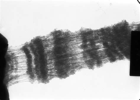 Drosophila Melanogaster Polytene Chromosome Cil24972 Doccheck